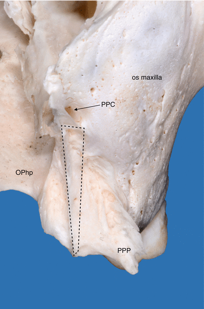 Pterygopalatine Fossa | SpringerLink