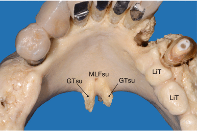 Anterior Mandible | SpringerLink