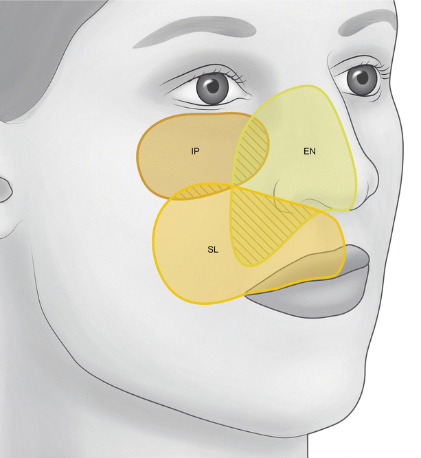 Infraorbital Region | SpringerLink