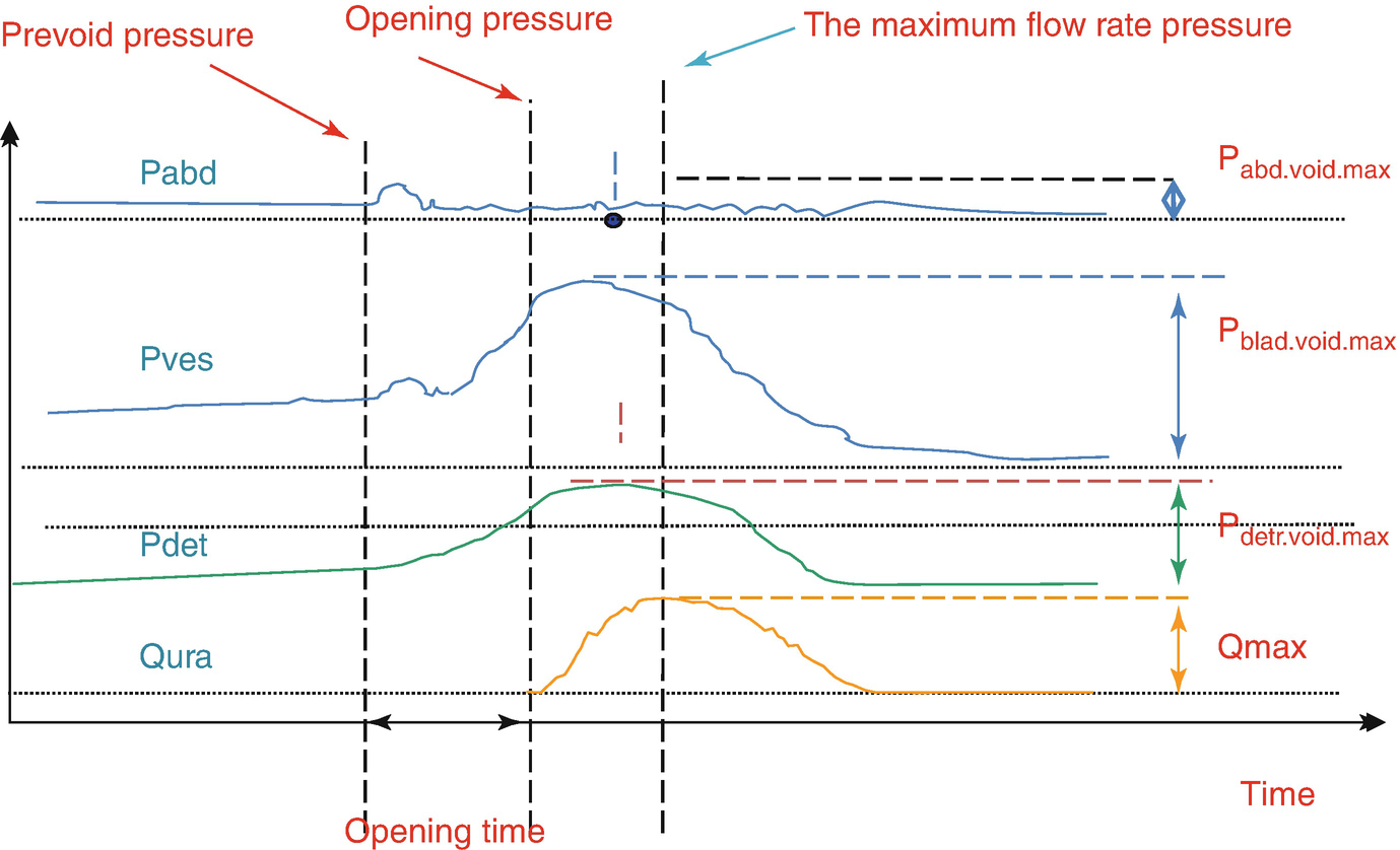 Cystometry, Pressure Flow Study and Urethral Pressure Measurement ...