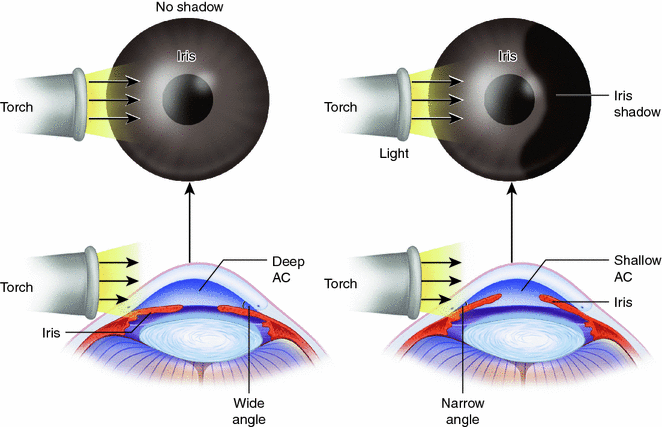 The Eyeball: Some Basic Concepts | SpringerLink