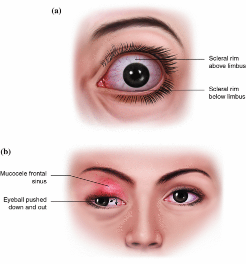 The Eyeball: Some Basic Concepts | SpringerLink