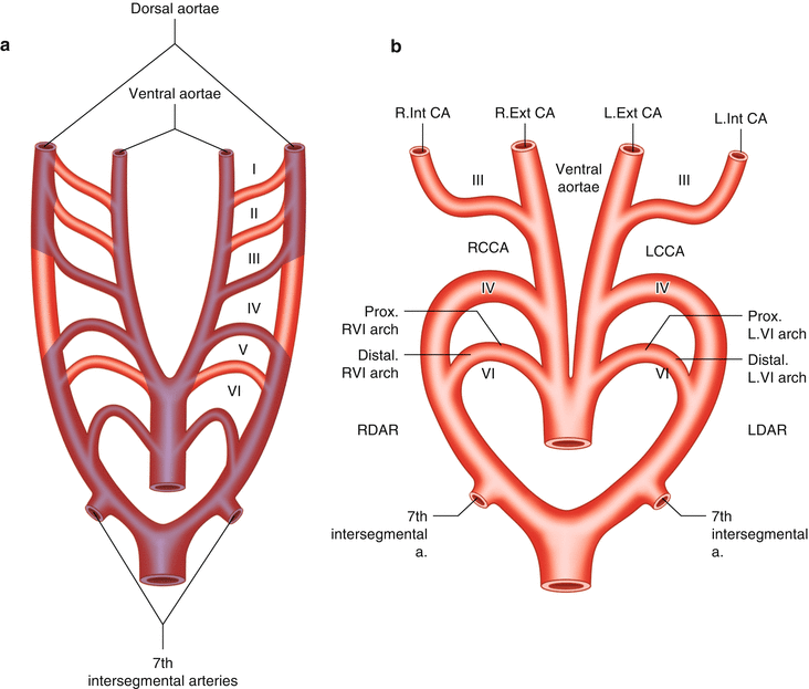 Vascular Rings and Anomalies of the Aortic Arch Vessels | SpringerLink