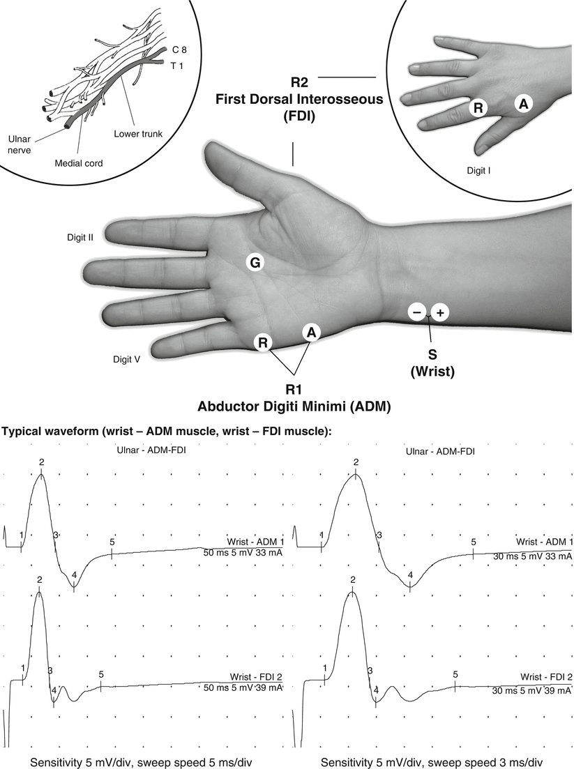 Wrist – Hand | SpringerLink