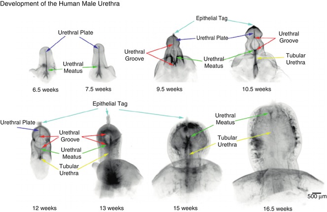 Embryology of the Penis | SpringerLink
