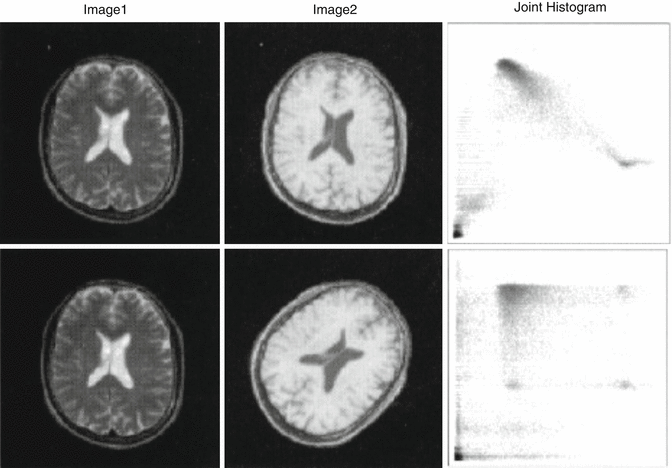 MRI Preprocessing | SpringerLink