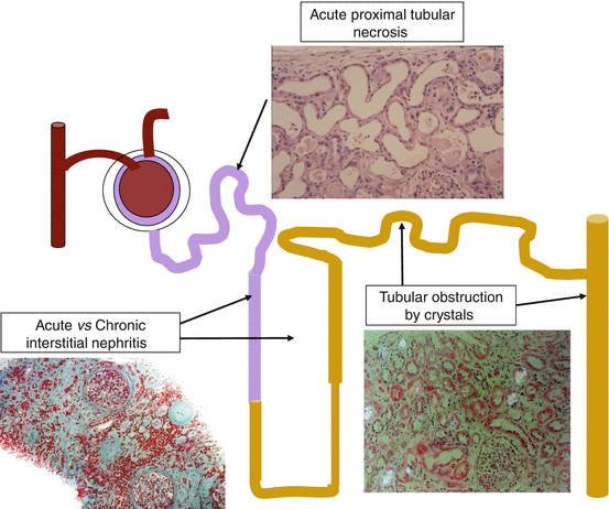Nephrotoxicity of Herbal Products | SpringerLink
