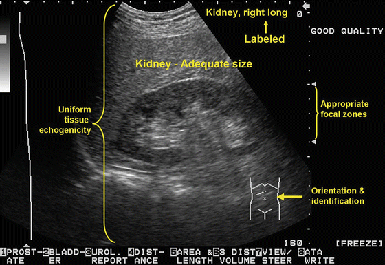 Urologic Ultrasound Protocols | SpringerLink
