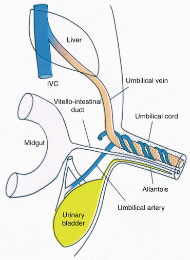 Umbilical Tumors | SpringerLink