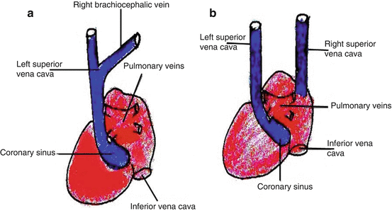 Cardiovascular System Embryology and Development | SpringerLink