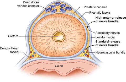 Transperitoneal Robot-Assisted Radical Prostatectomy: Posterior ...