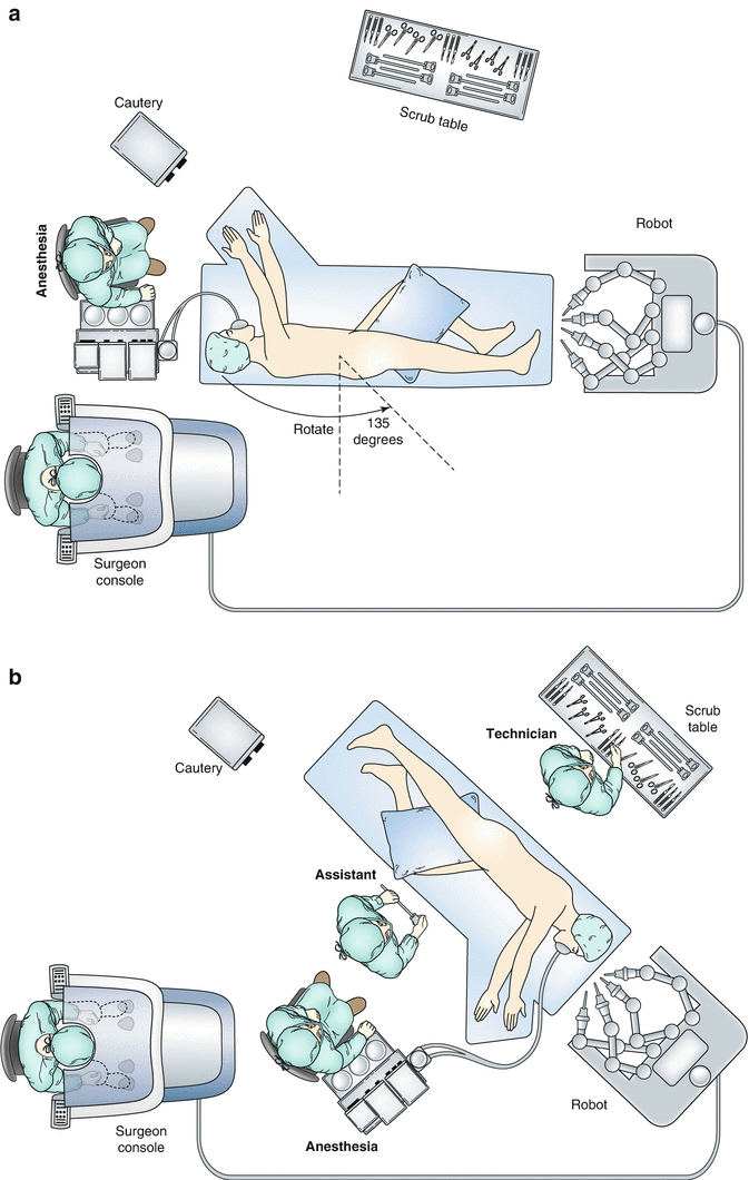 Retroperitoneal Robotic Partial Nephrectomy | SpringerLink
