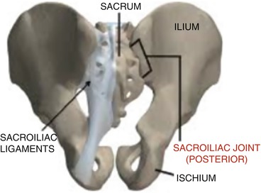 Sacroiliac Joint Complex Pain | SpringerLink
