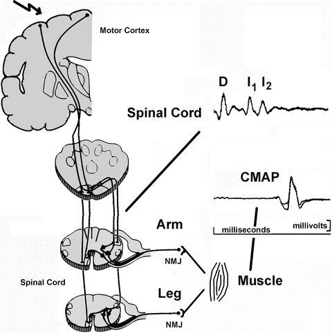 Transcranial Motor-Evoked Potentials | SpringerLink