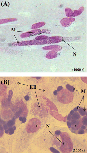Ehrlichia ruminantium: The Causal Agent of Heartwater | SpringerLink