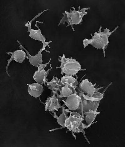 Platelet Shape Change | SpringerLink