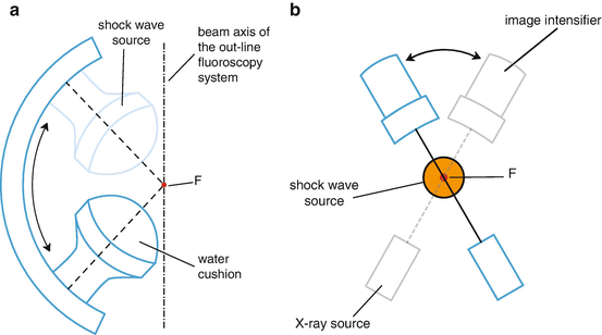 Shock Wave Lithotripsy | SpringerLink