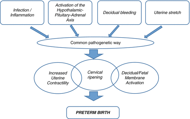 Preterm Birth: Risk Factors, Identification and Management | SpringerLink