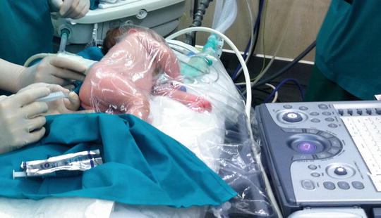 Local and Regional Anesthesia in Pediatrics | SpringerLink