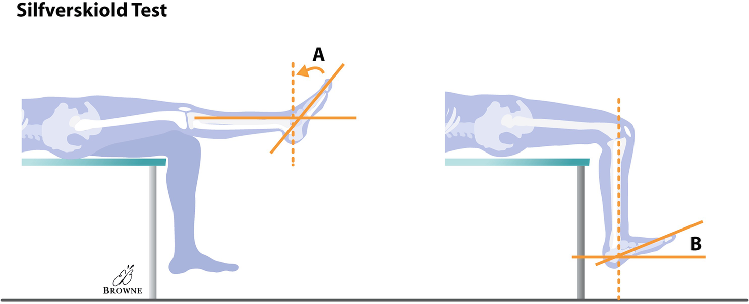 Ankle Equinus in Cerebral Palsy | SpringerLink