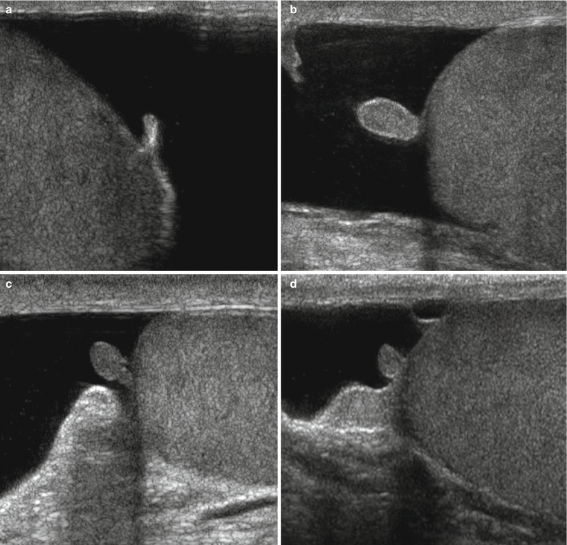 Scrotal and Testicular Anatomy | SpringerLink