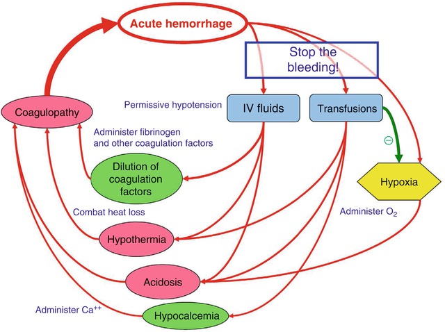 Damage Control Resuscitation | SpringerLink