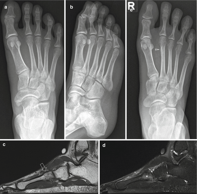 Radiography Limitations and Pitfalls | SpringerLink