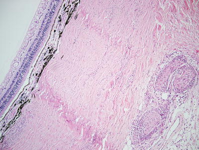 Fungal Infections | SpringerLink