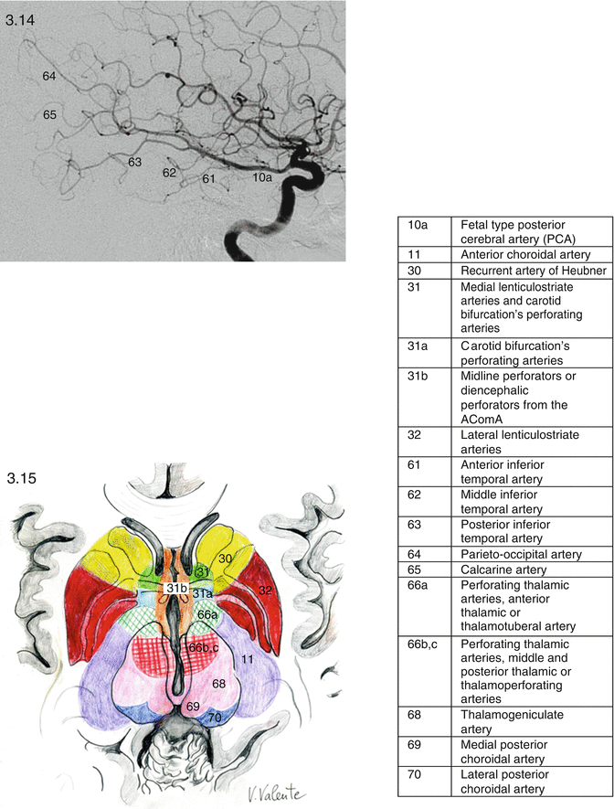 Supratentorial Vascular Anatomy | SpringerLink