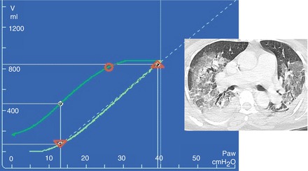 Pressure-Volume Loop | SpringerLink