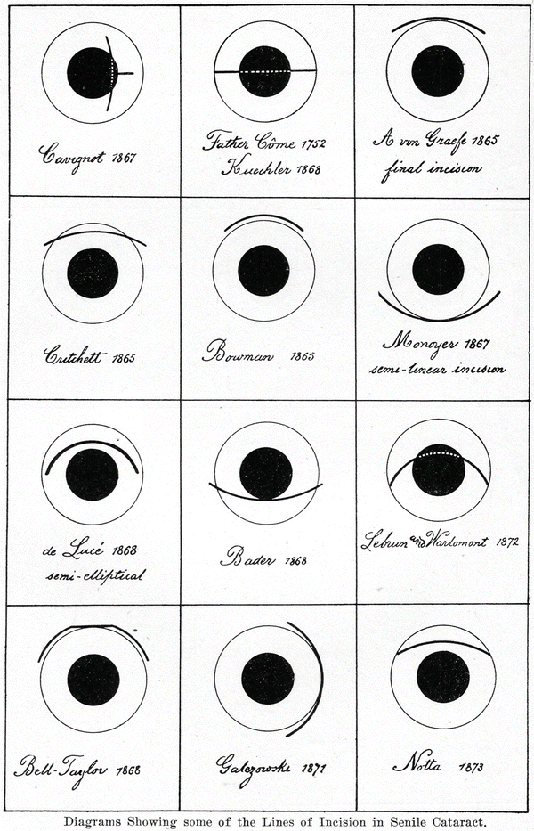 Albrecht von Graefe: The Beginnings of Scientific Ophthalmology and ...
