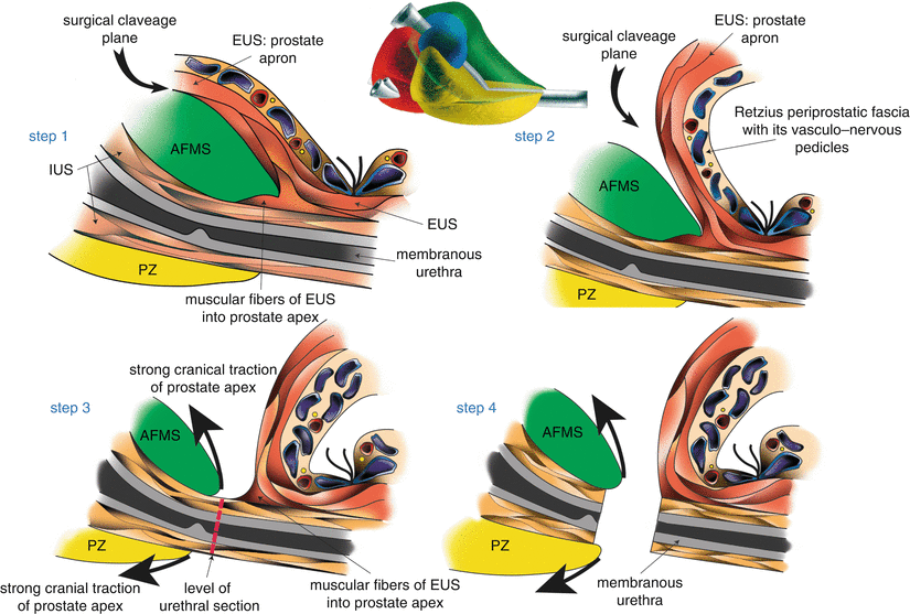 Anatomy of the Prostate | SpringerLink