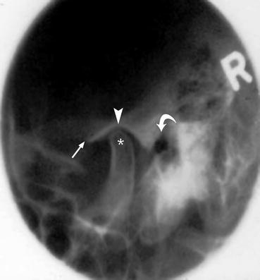Imaging of the TMJ | SpringerLink