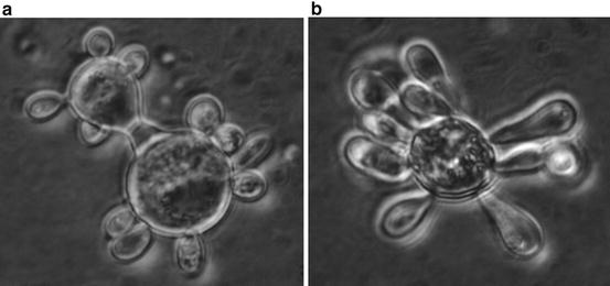 Paracoccidioides spp. and Paracoccidioidomycosis | SpringerLink