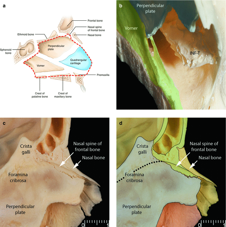 Septum, Turbinates, Valves | SpringerLink