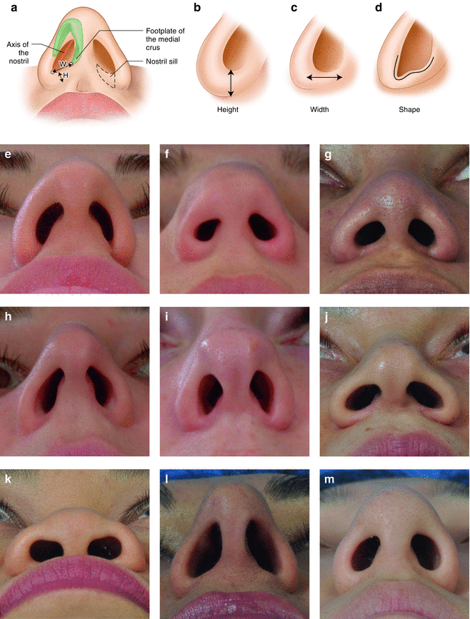 Nasal Base | SpringerLink
