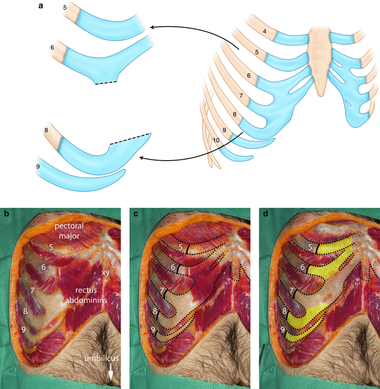 Grafts | SpringerLink