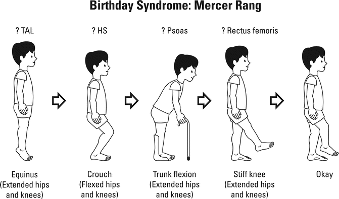 Integrated Management in Cerebral Palsy: Musculoskeletal Surgery and ...
