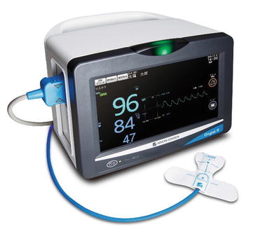 Gases | SpringerLink