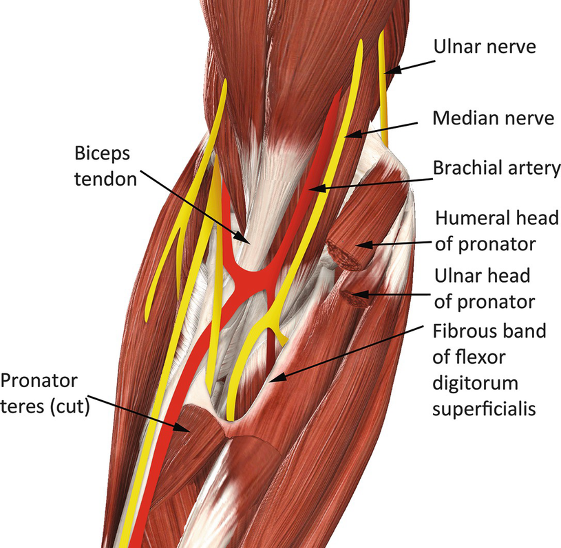 Nerve Entrapment Syndromes | SpringerLink