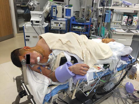 Intracranial Procedures in the Lateral Position | SpringerLink