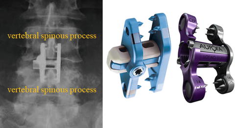 Materials for Orthopedic Applications | SpringerLink