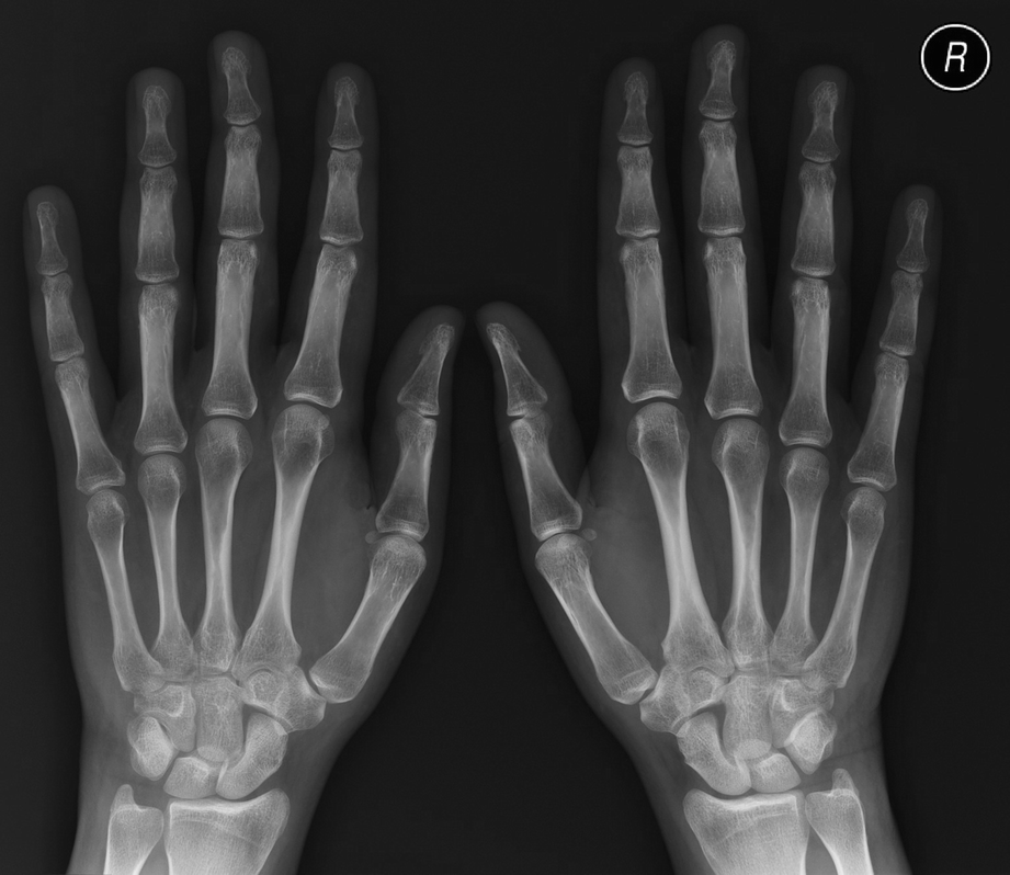 Imaging Anatomy: Conventional Radiography | SpringerLink