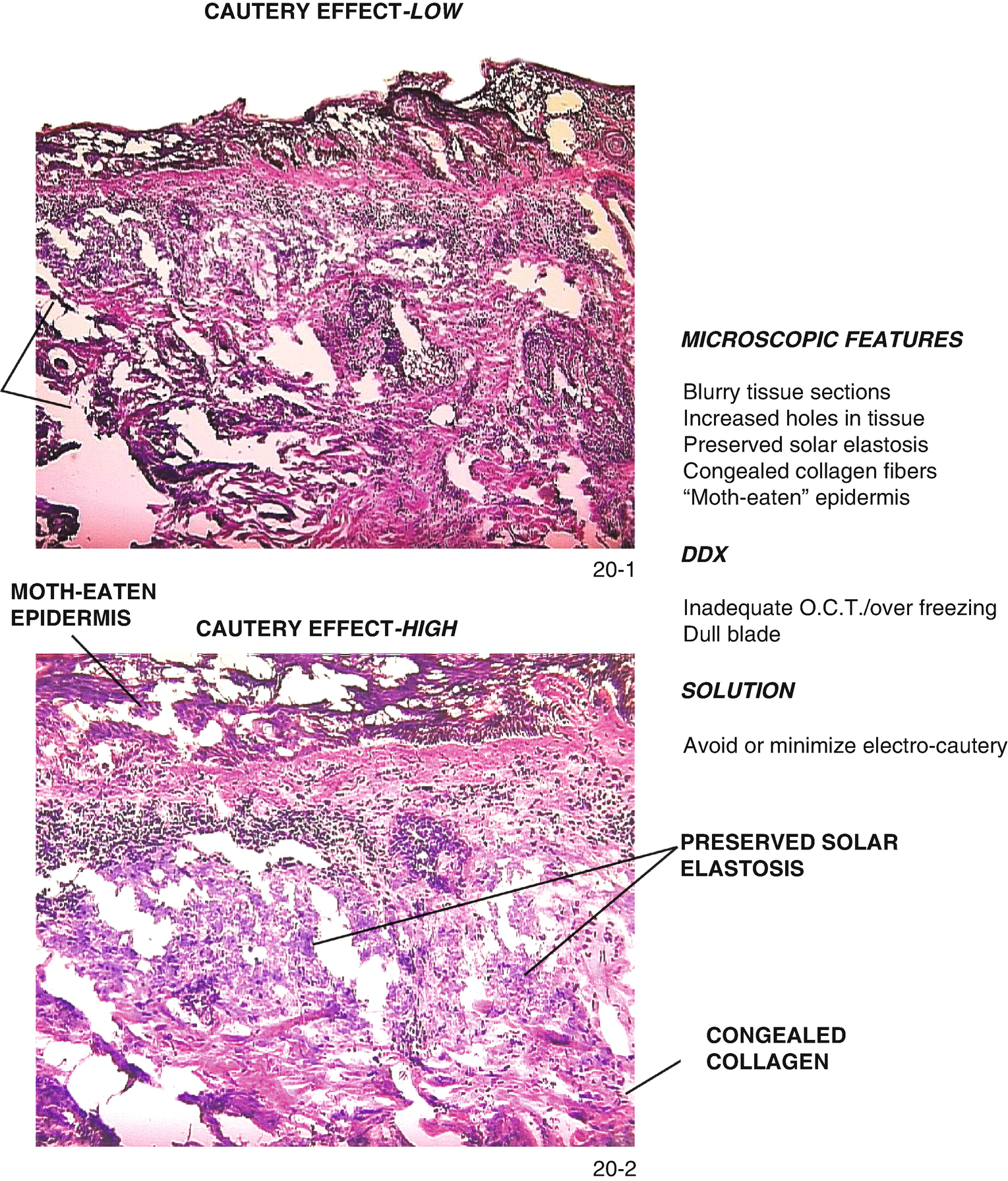 Histotechnique and Staining Troubleshooting | SpringerLink