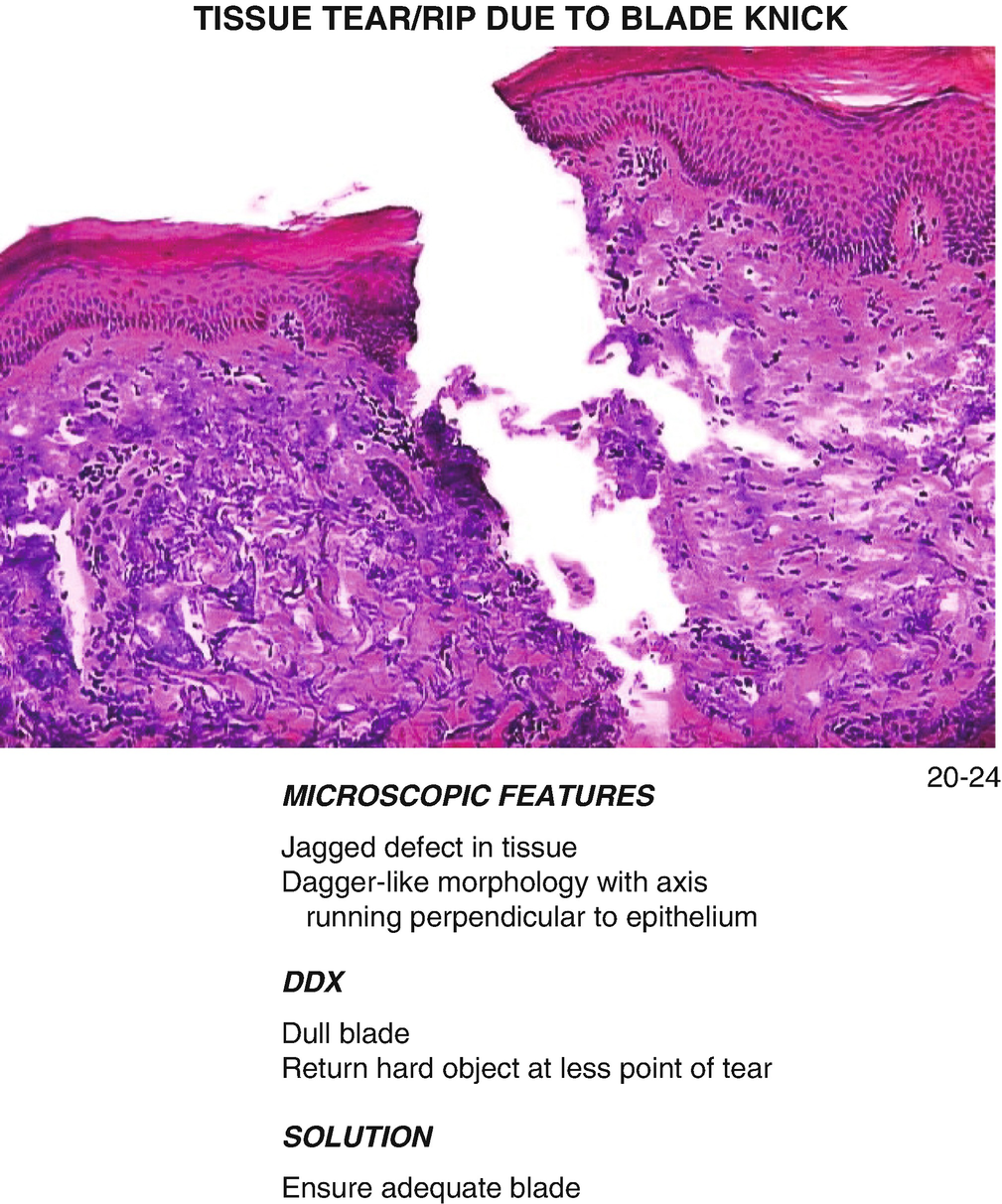 Histotechnique and Staining Troubleshooting | SpringerLink