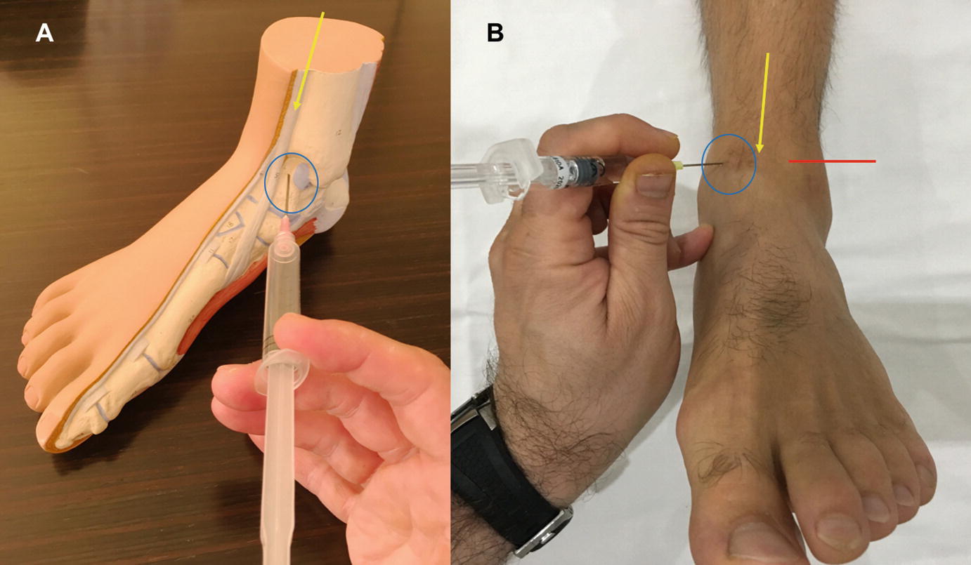 Hyaluronic Acid | SpringerLink