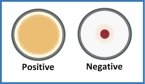 Treponema pallidum Hemagglutination (TPHA) Test | SpringerLink