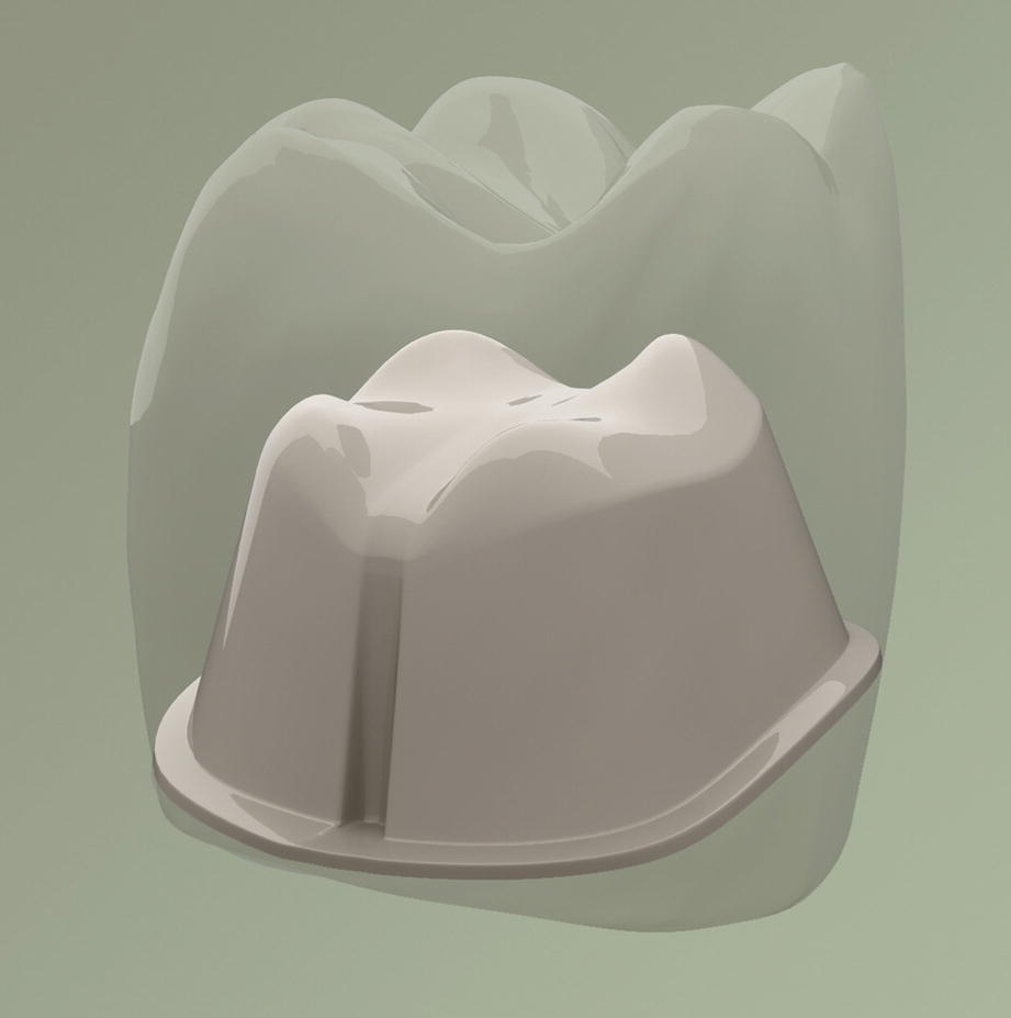 Fundamentals of Tooth Preparation | SpringerLink