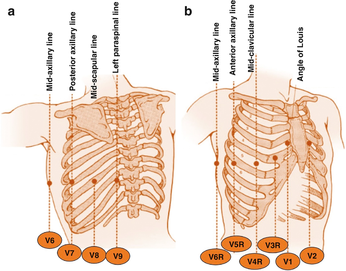 Fundamentals of ECG | SpringerLink