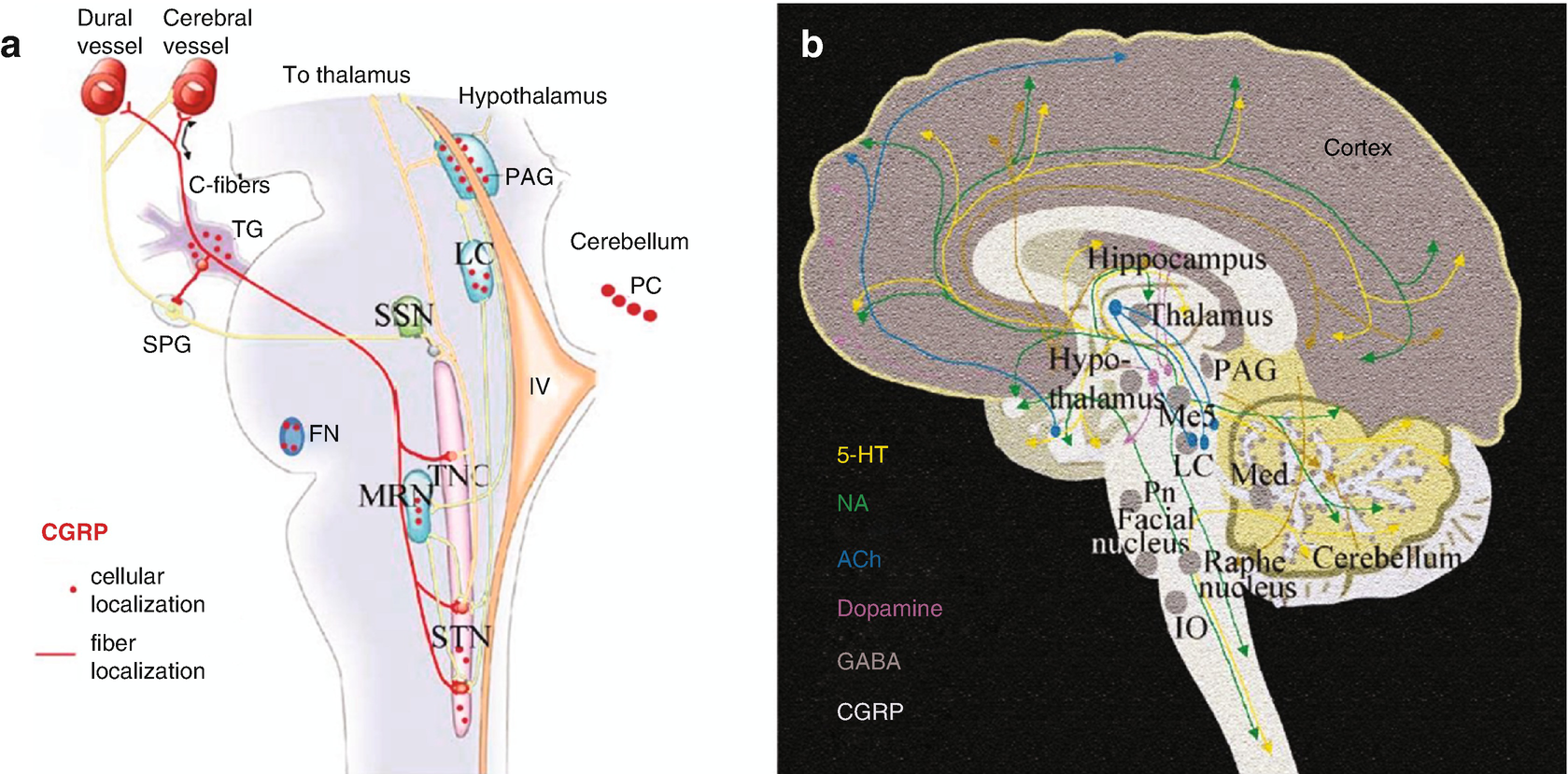 Chronic Migraine: Epidemiology, Mechanisms, and Treatment | SpringerLink